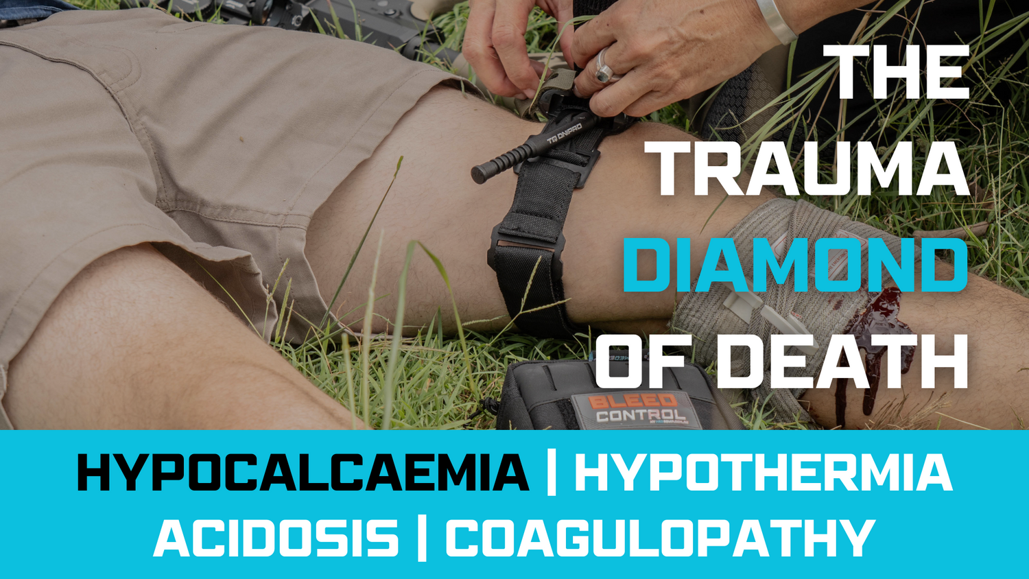The Trauma Diamond of Death – MyMedEquip